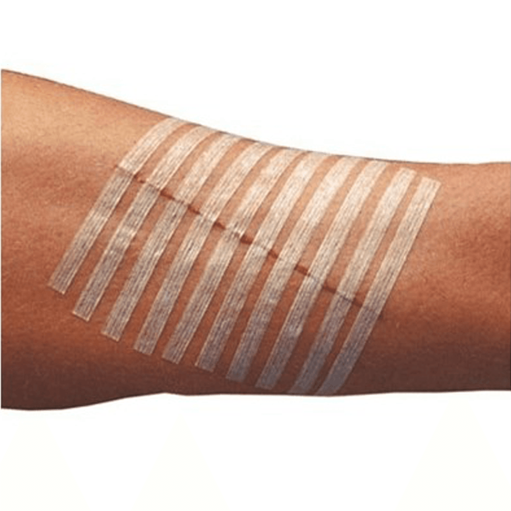 Buy Wound Closure Strips Online
